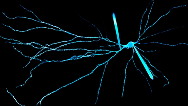 The Electric Signals That Make the Human Brain Unique – breathwork-science